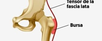 Bursitis de cadera: Síntomas, causas y tratamientos - Blog Clínica ...