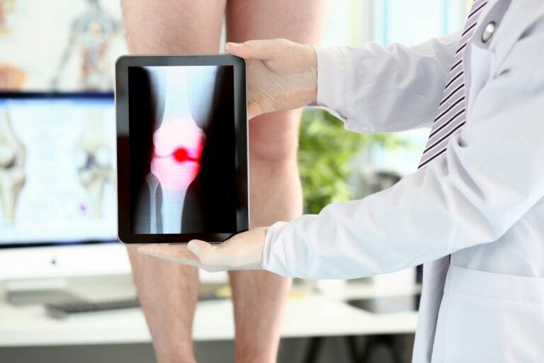 Problemas causados por el líquido en la rodilla y cómo tratarlos - Blog ...