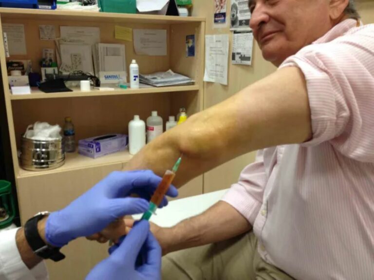 Bursitis en el Codo: Causas, síntomas y tratamiento - Blog Clínica Privada Jaime I Catarroja en ...