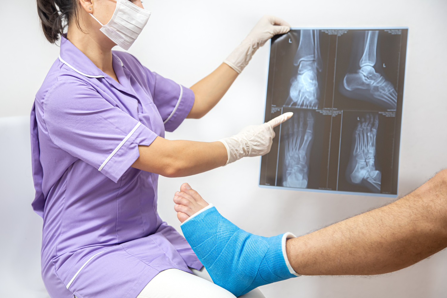 Tendinitis de peroneos: Causas, síntomas y tratamiento para esta lesión ...
