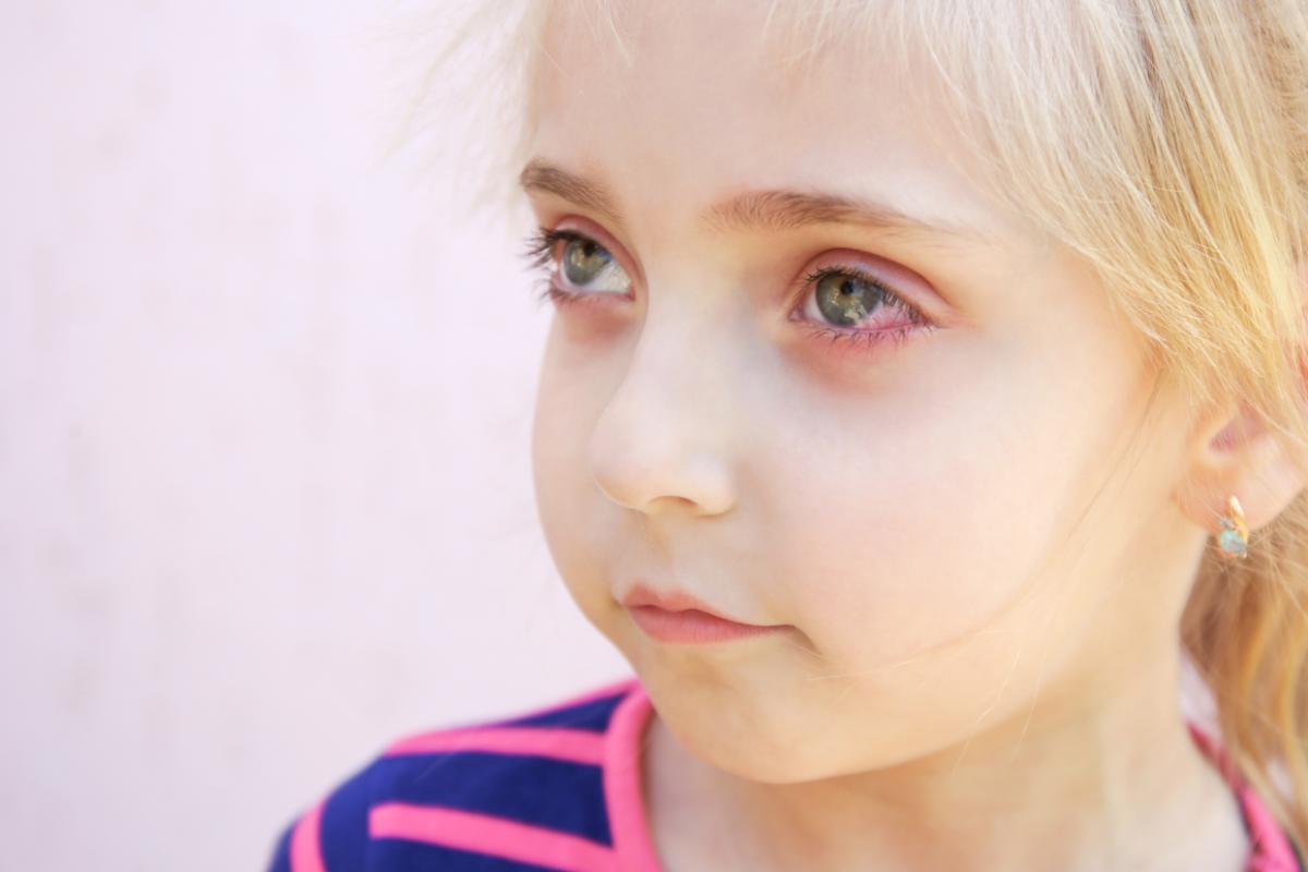 Conjuntivitis en niños: Causas, síntomas y tratamiento