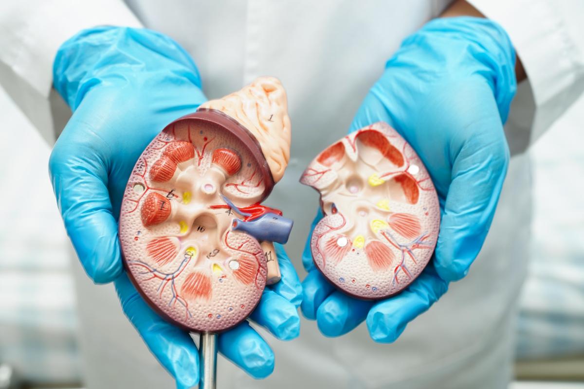 Litiasis Renal: Causas, Síntomas y Tratamiento en España