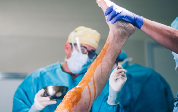 Artroplastia de rodilla | Prótesis de rodilla en Valencia | Clínica ...