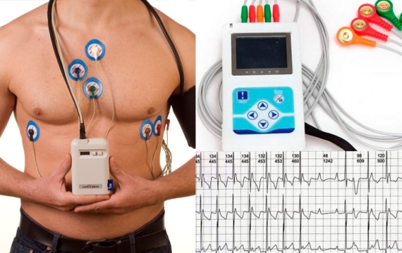 Holter ECG en Valencia | Clínica Jaime I Catarroja - Valencia