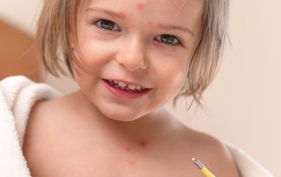 Dermatología Infantil en Valencia | Clínica Jaime I Catarroja - Valencia